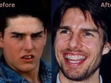 The Story Behind Tom Cruise S Teeth Middle Tooth To Signature Smile